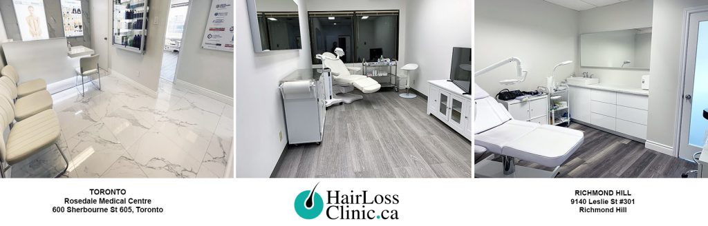 Alopecia Hair Loss Treatment Men And Women Trichology Centre